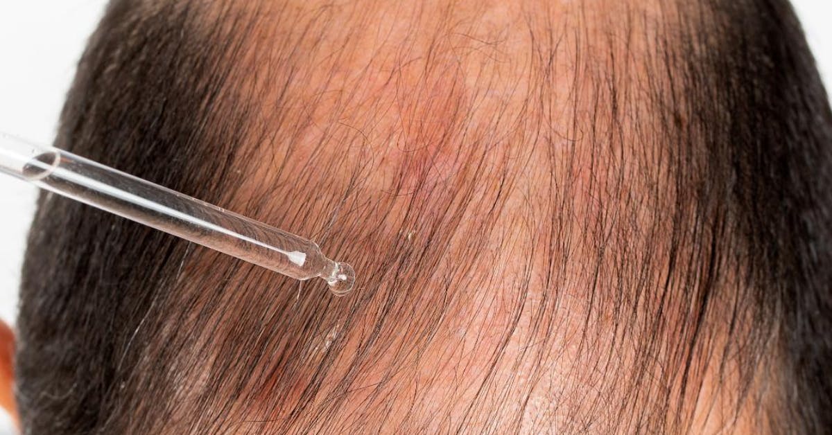 Betacap Scalp Application Reviews: Comprehensive Insights | medino