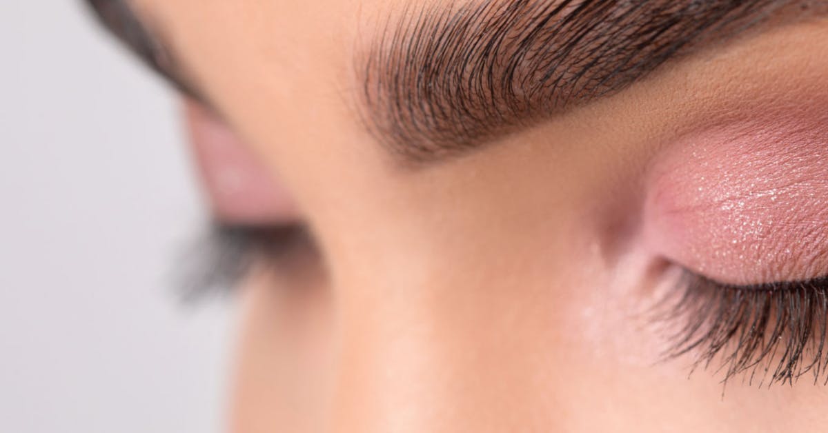 Blepharitis Explained: Causes & How to Treat It | medino